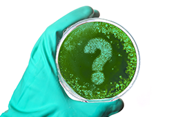 What is Macro Virus? | Types and Methods to Prevent Macro Virus